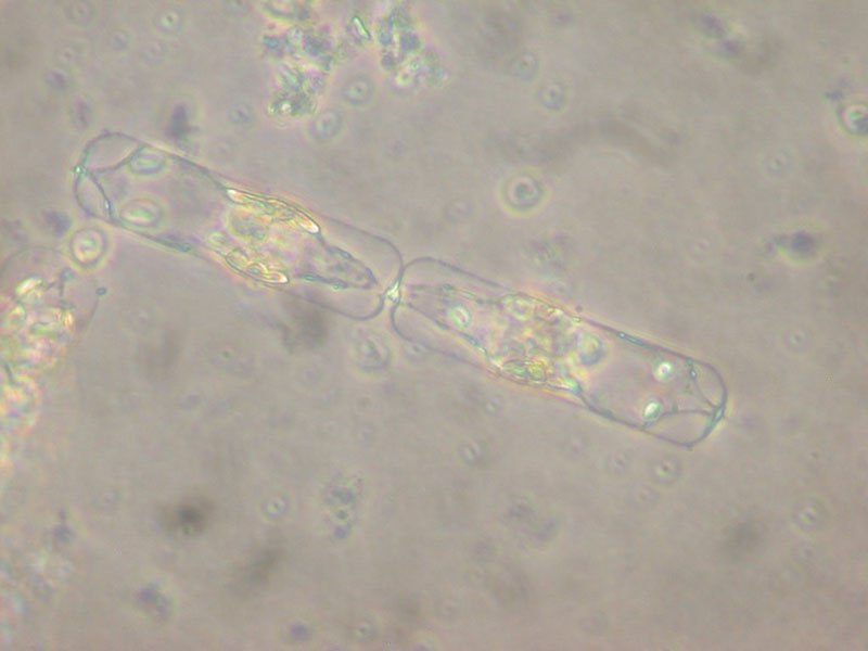 Major Algal Groups: Diatoms