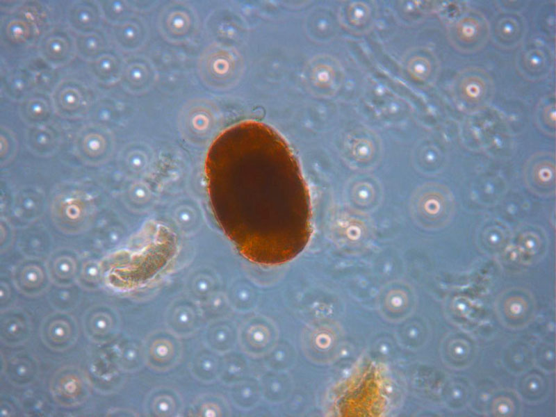 Major Algal Groups: Dinoflagellates